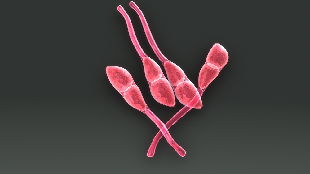 Pilzinfektion - Arten, Ursachen, Symptome, Diagnose und Behandlung